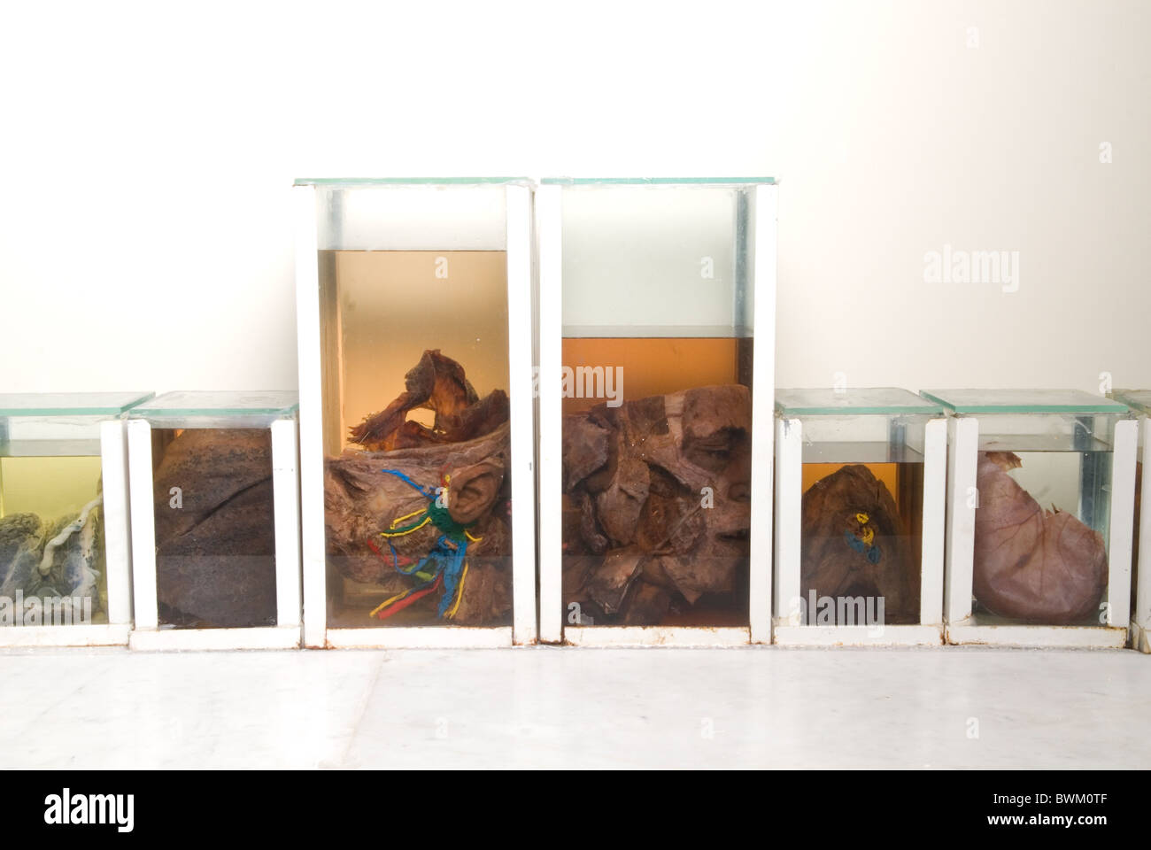 Human organs anatomy hi-res stock photography and images - Alamy