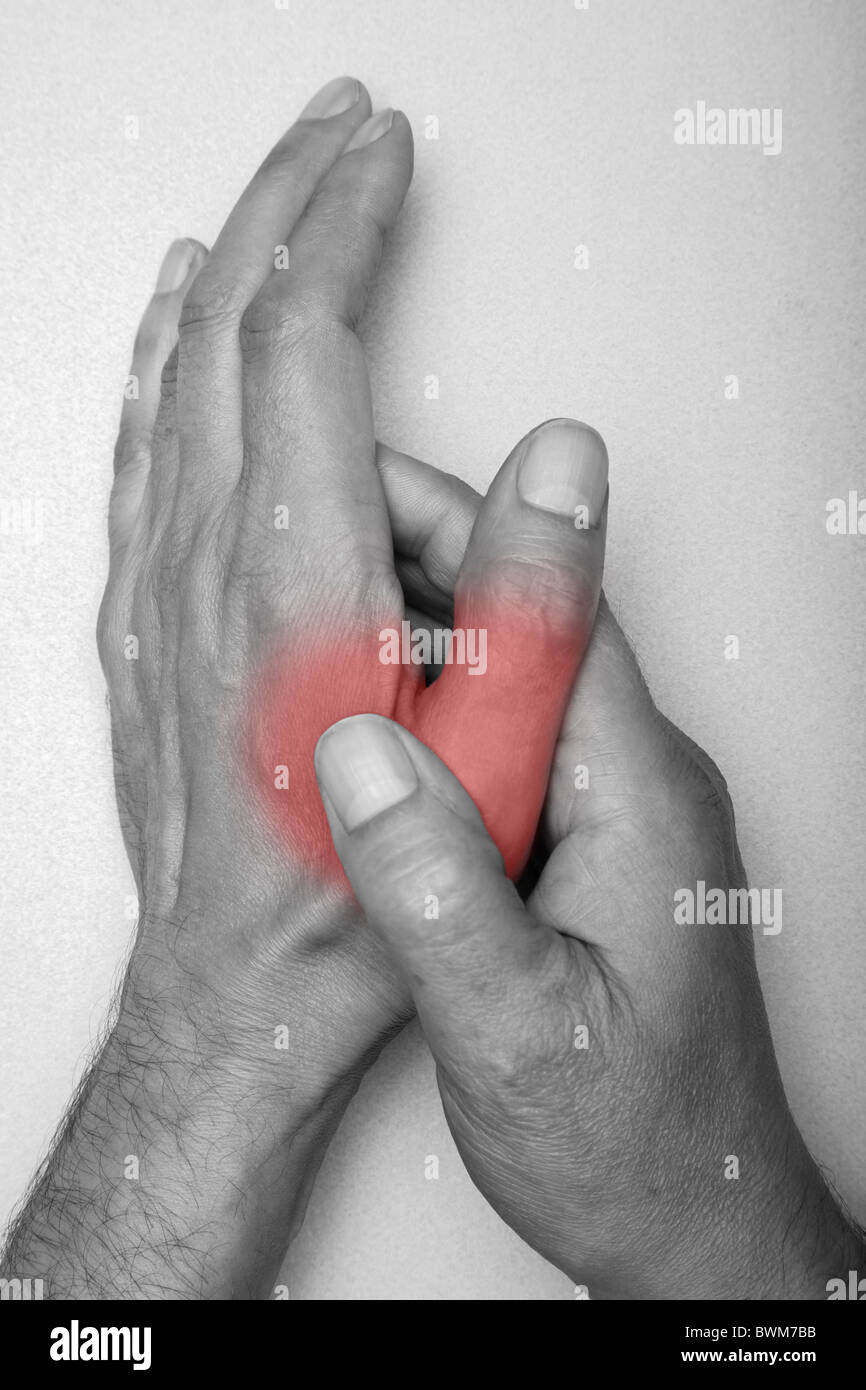 Hand Knuckle Joints Parts