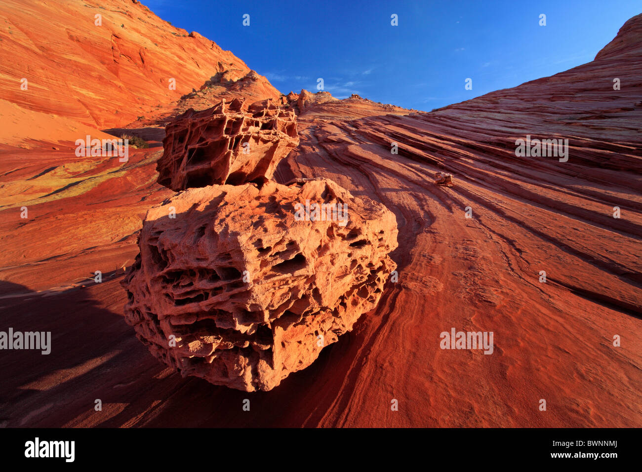 Bone erosion hi-res stock photography and images - Alamy