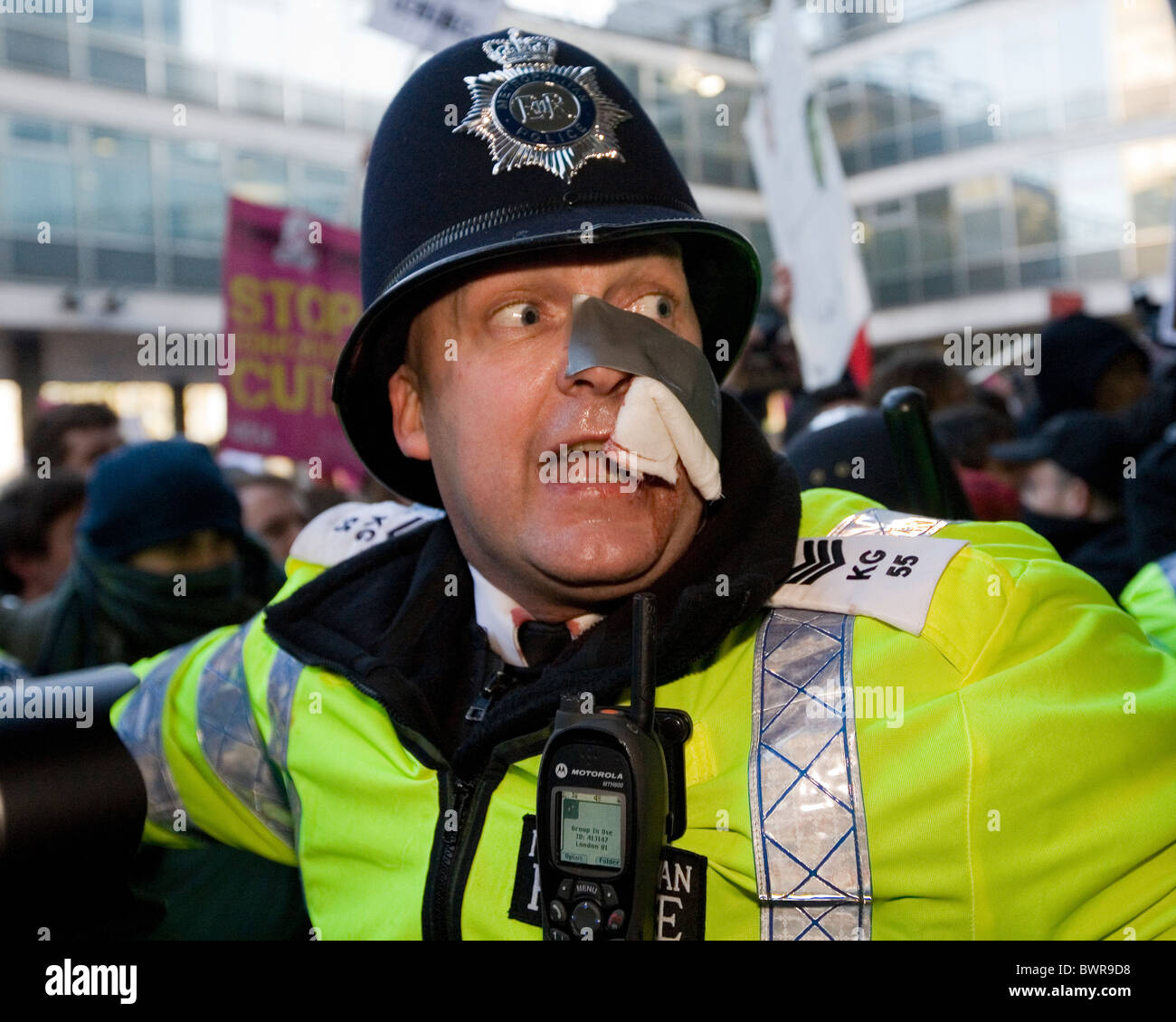 A wounded policeman who was hit by a thrown missile during a riot at ...
