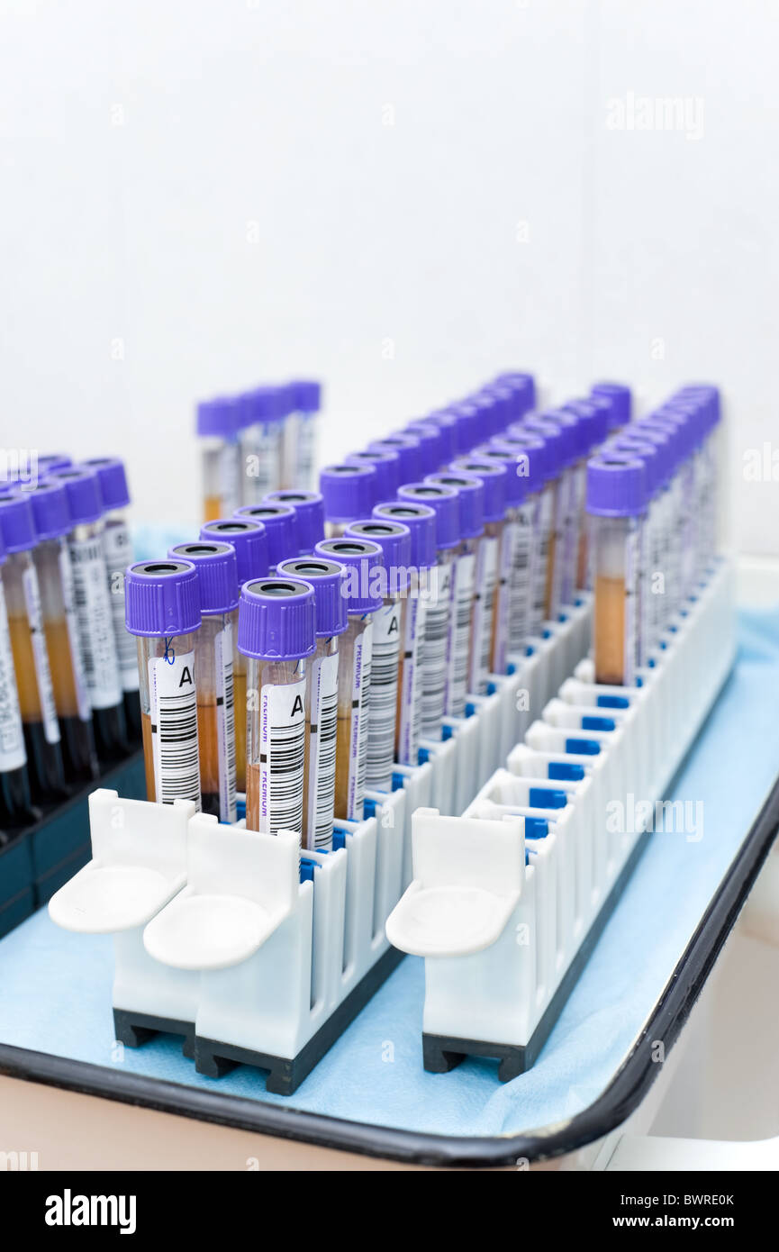 many test tubes with donor blood being tested, copy space Stock Photo ...