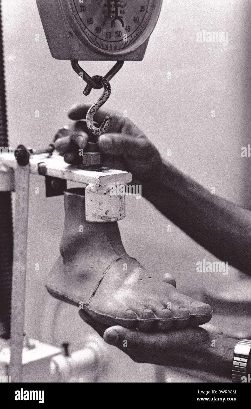 India. Technician in a workshop making artificial 'Jaipur Limb ...