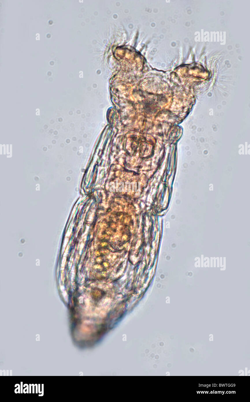 Collotheca rotifer feeding on bacteria Stock Photo - Alamy