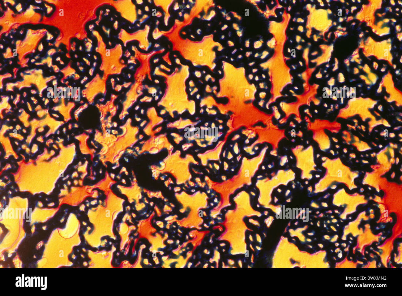 1 shows alveolus 10067091 medicine microscope microscopy lung color hi ...