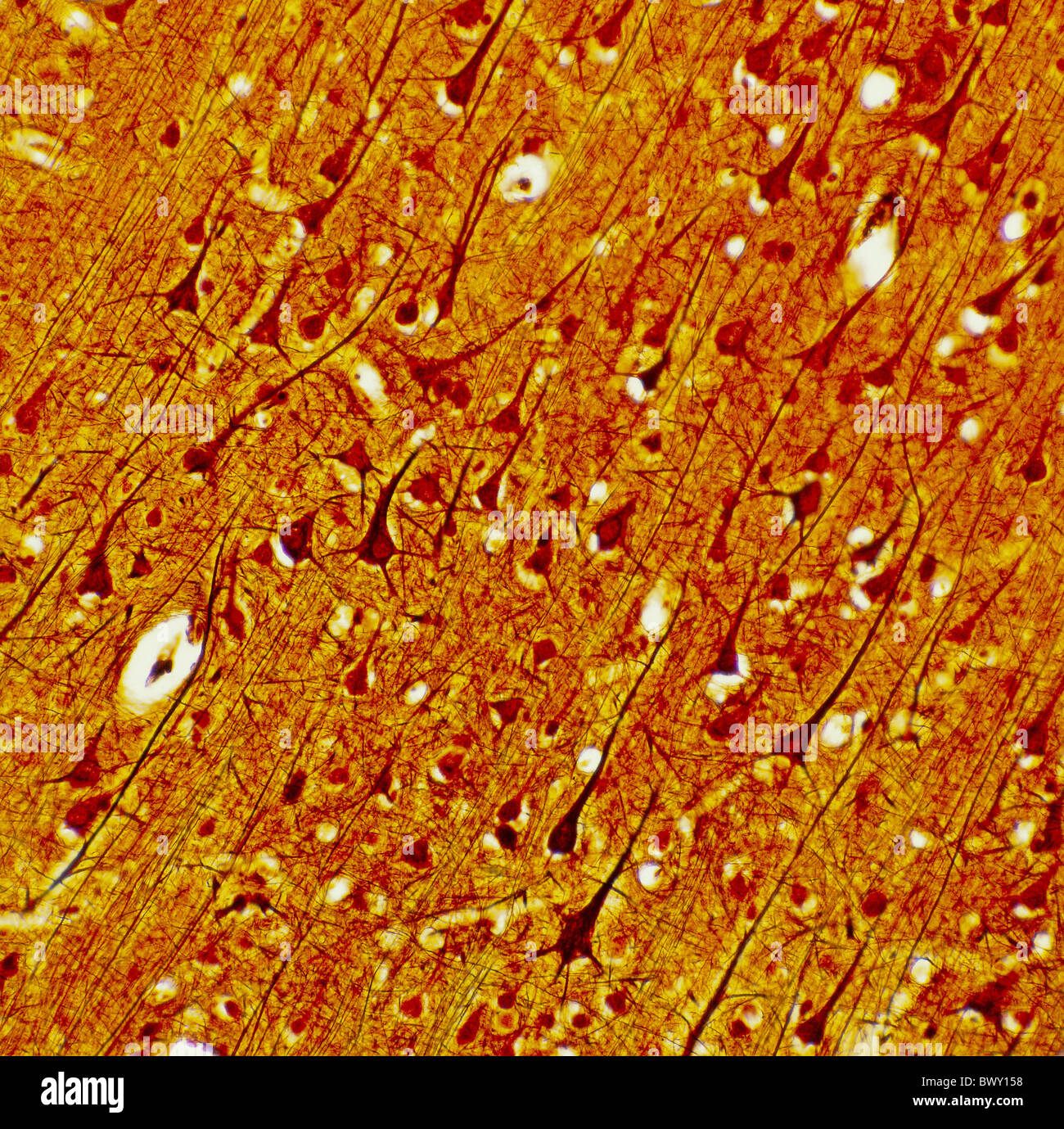 medicine microscope microscopy 80 1 cerebrum nerve cells colored ...