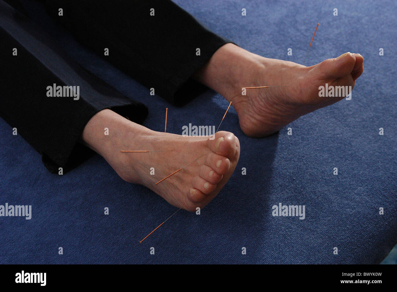 acupuncture Alternative medicine brooches feet legs needles Stock Photo ...