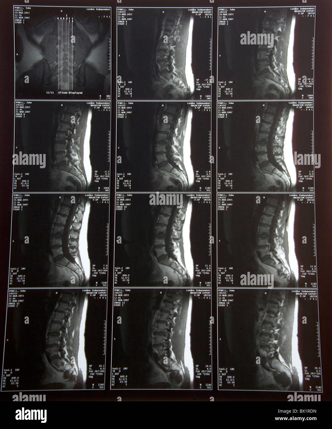 backbone hospital magnetic resonance medicine MRI Stock Photo - Alamy