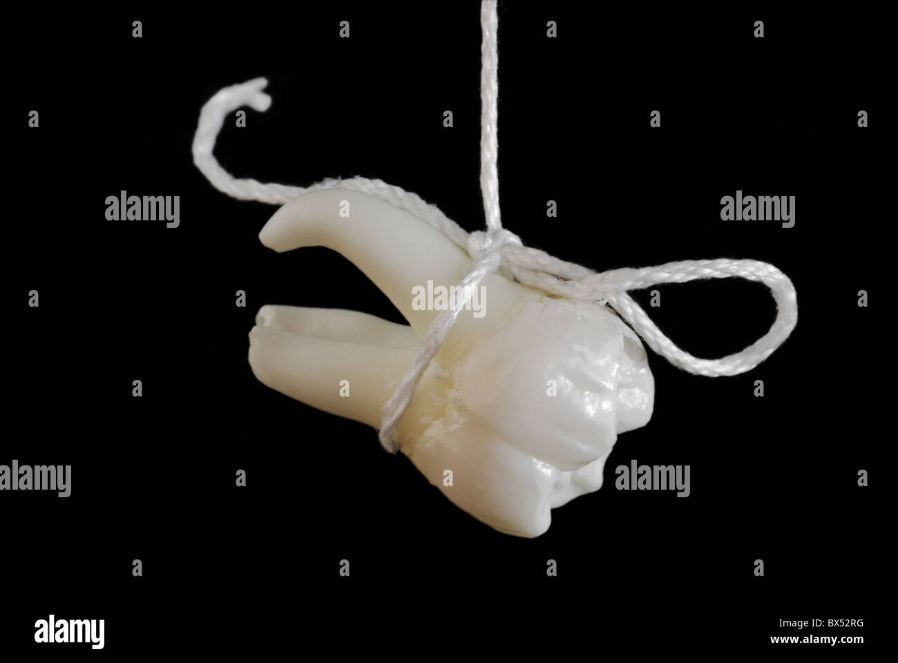 Tooth extraction hi-res stock photography and images - Alamy