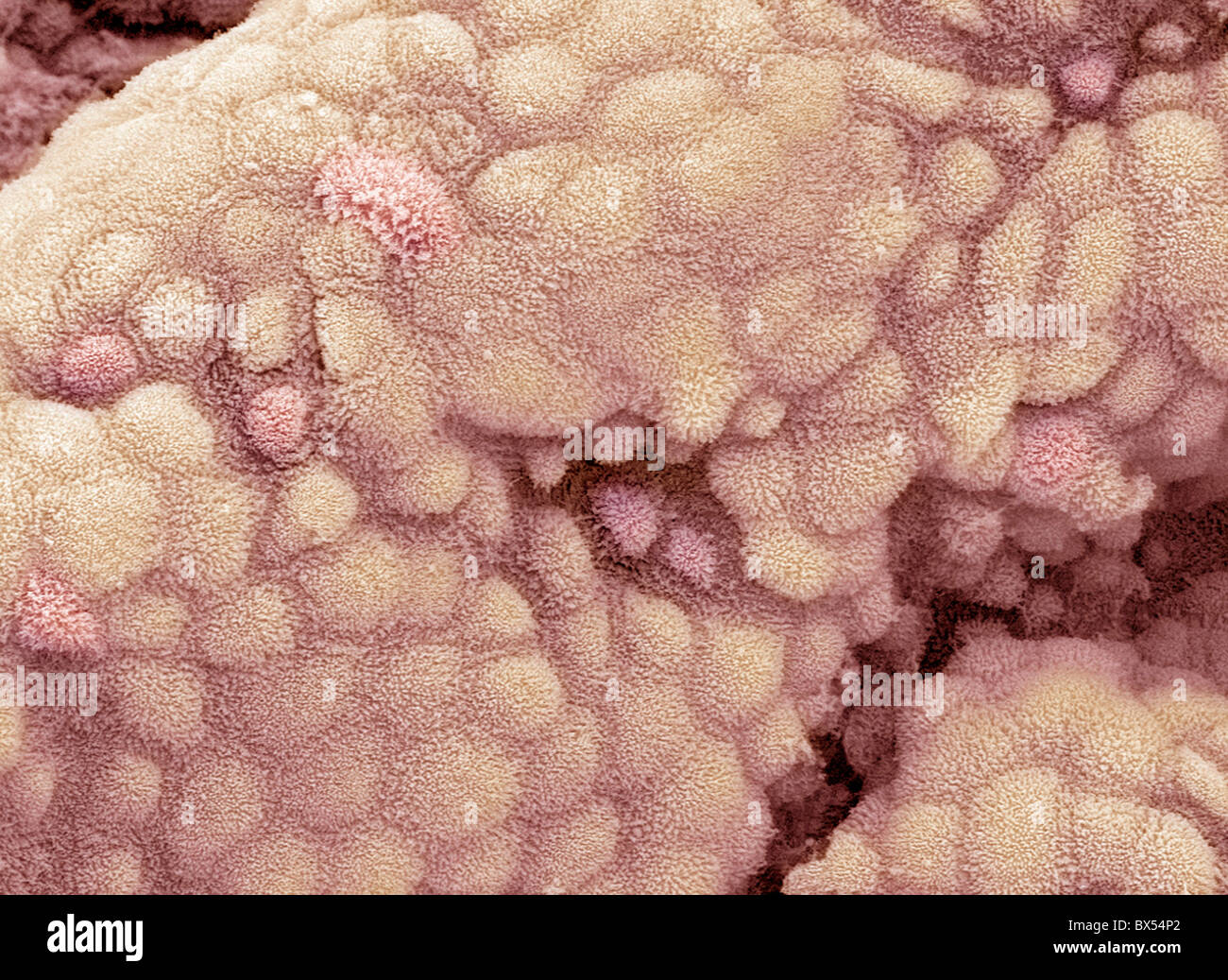 Gallbladder surface, SEM Stock Photo - Alamy