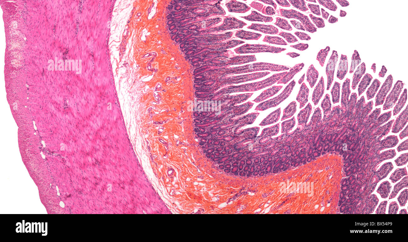 Villi small intestine hi-res stock photography and images - Alamy