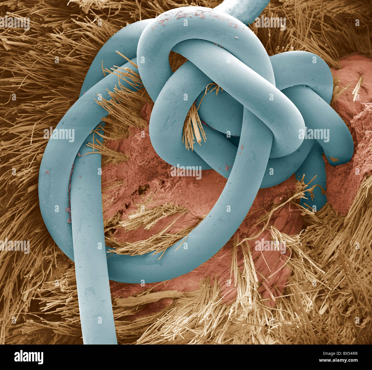 Sutured wound, SEM Stock Photo - Alamy