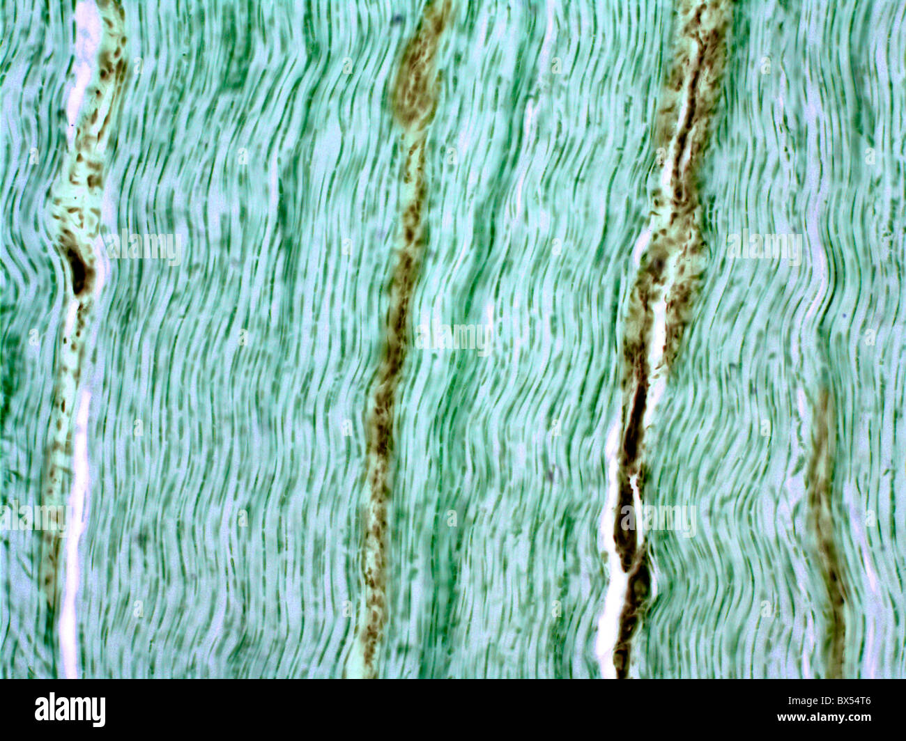 Tendon, light micrograph Stock Photo - Alamy