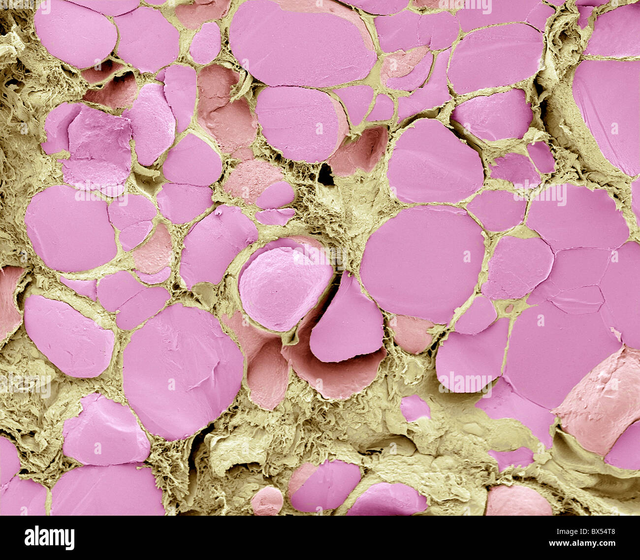 Thyroid gland cross section hi-res stock photography and images - Alamy