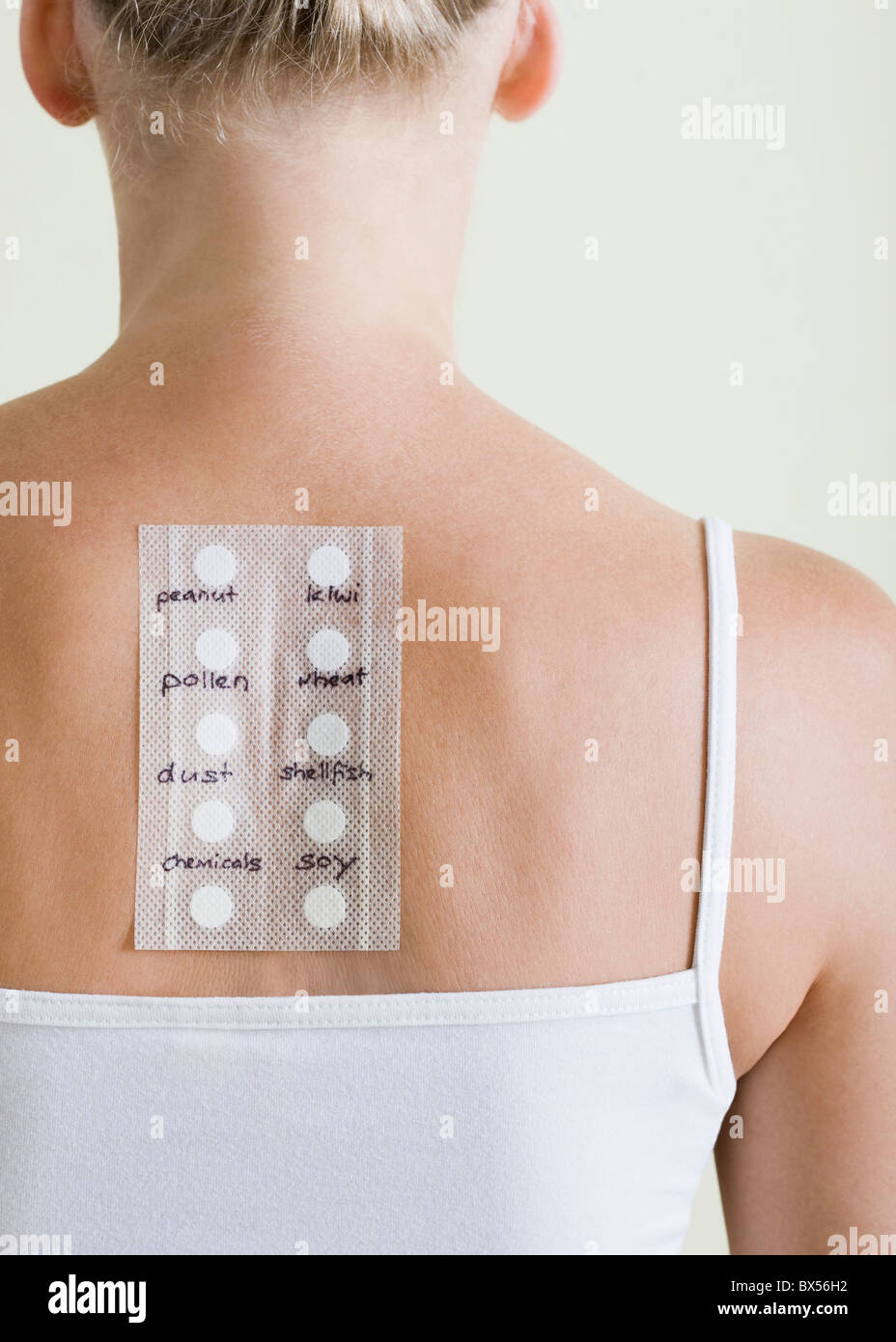 Allergy test reaction hi-res stock photography and images - Alamy