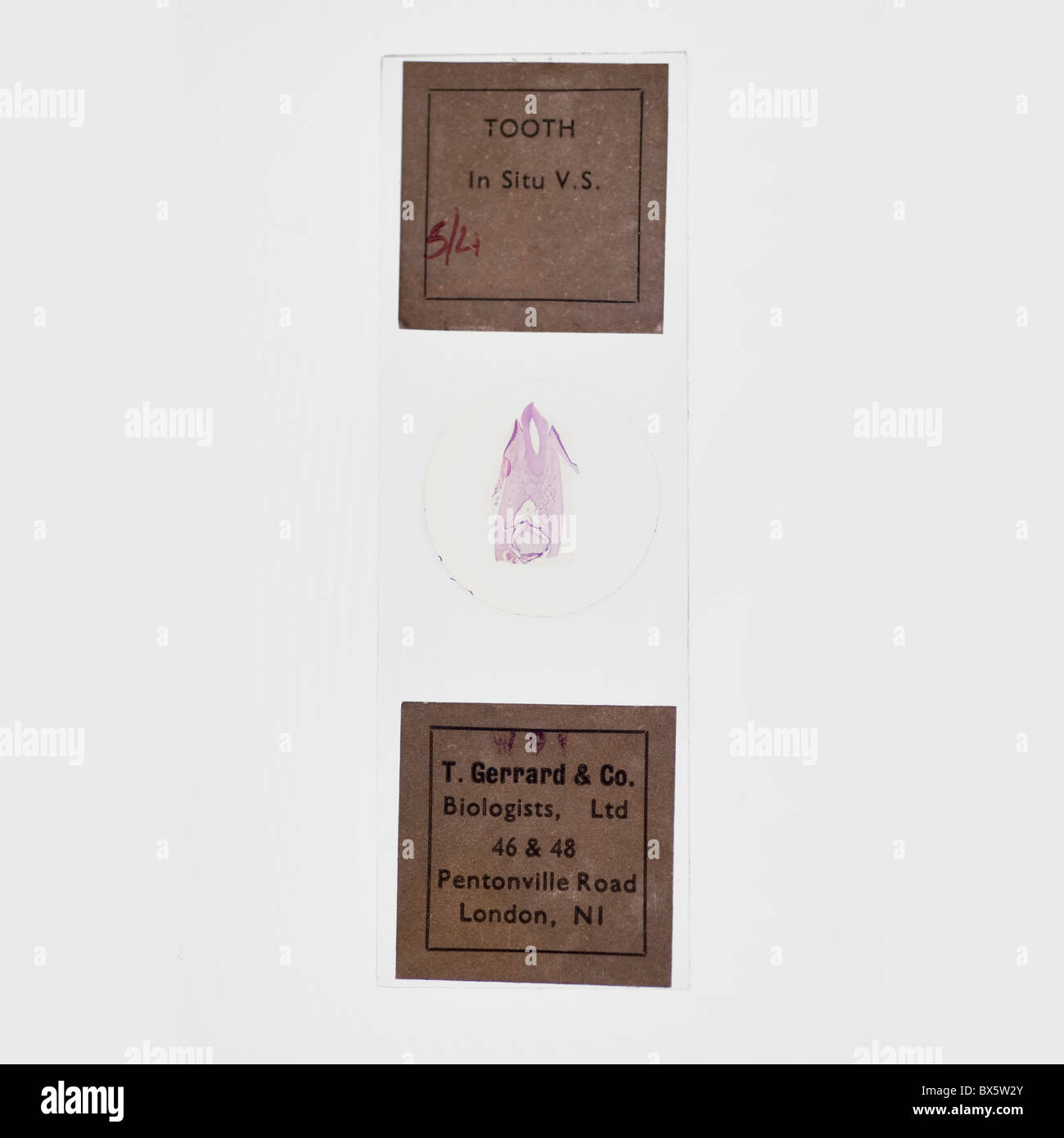 Human tooth microscope hi-res stock photography and images - Alamy