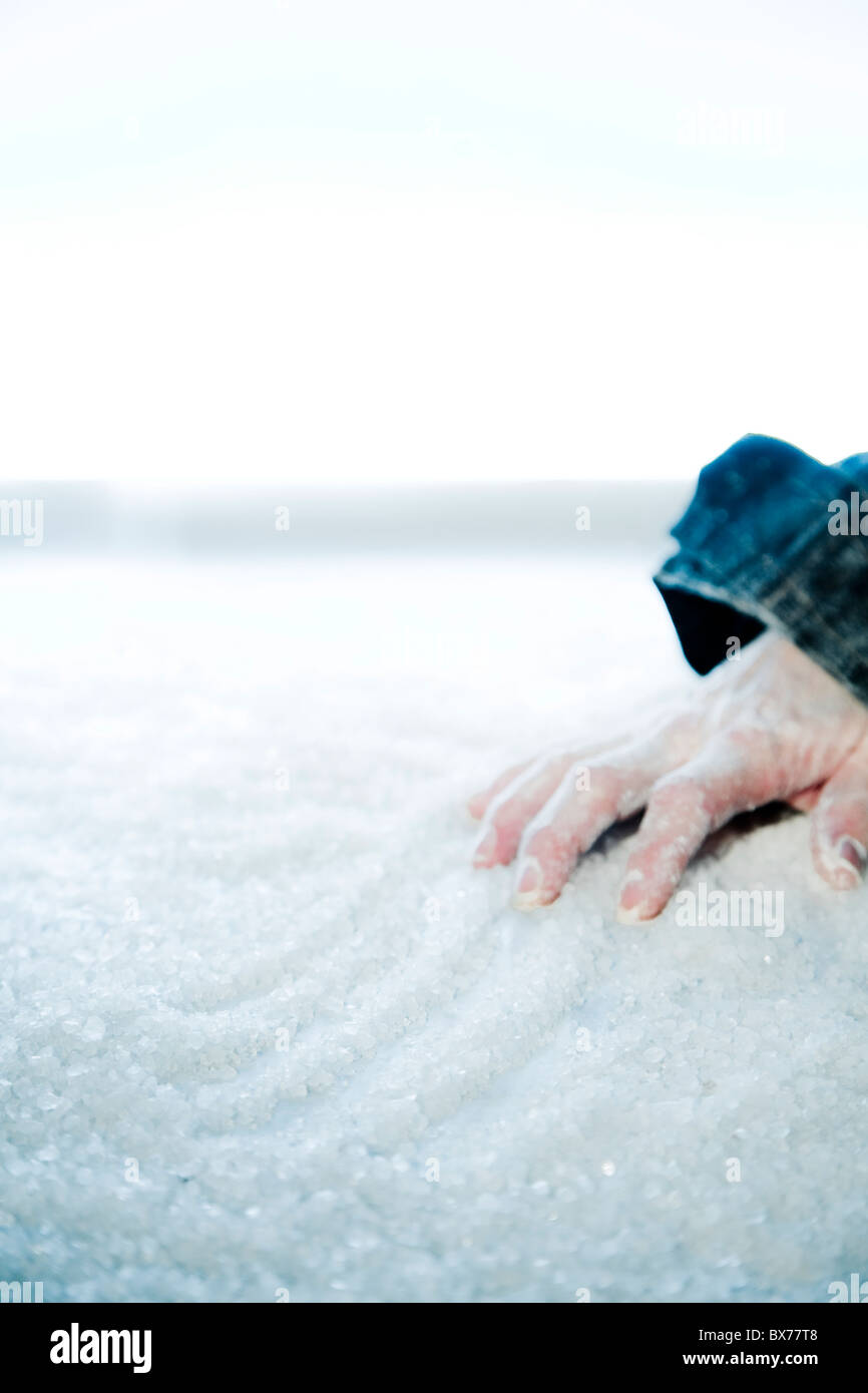 Frostbite hand hi-res stock photography and images - Alamy