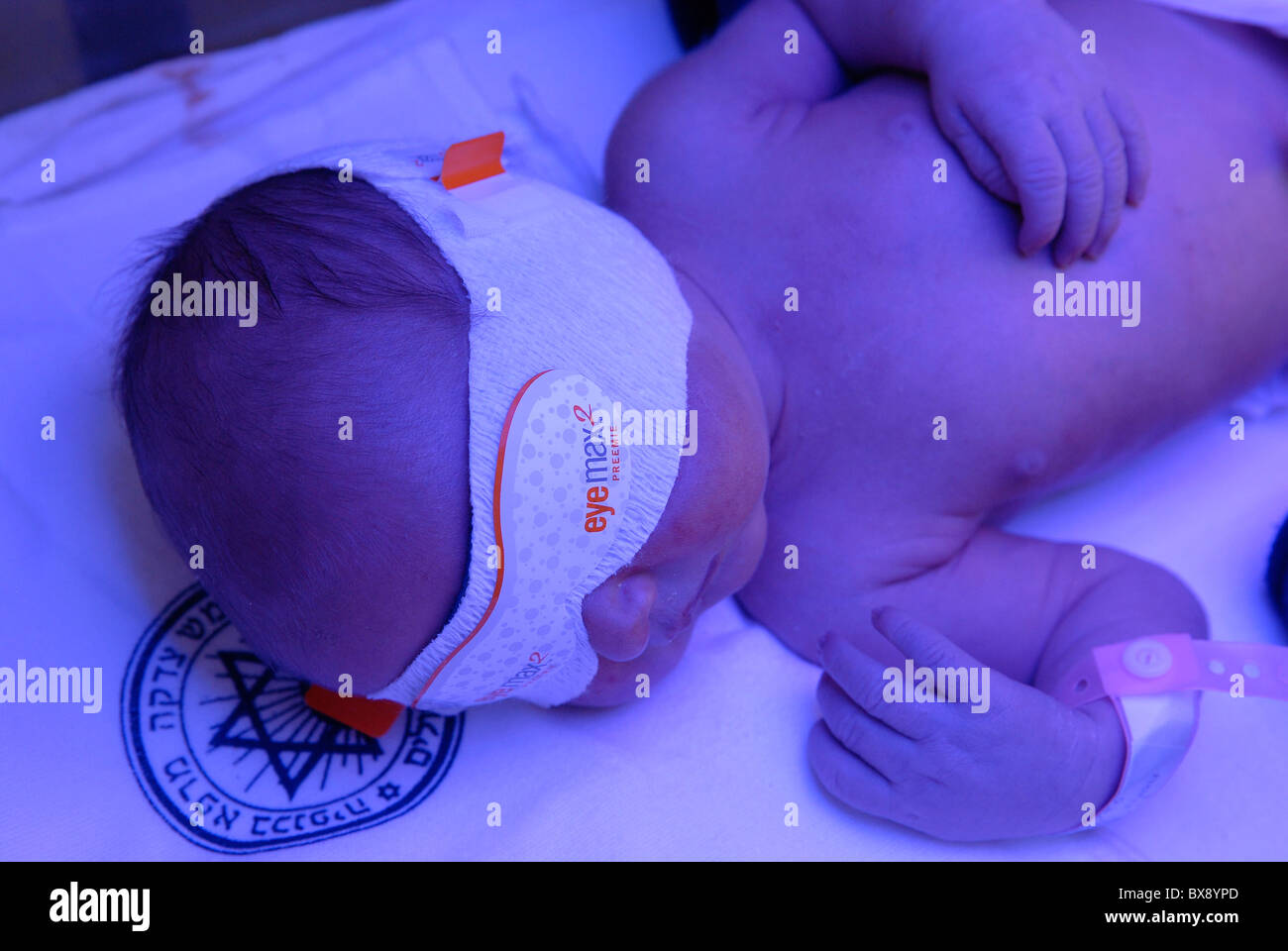Uv light therapy hi-res stock photography and images - Alamy