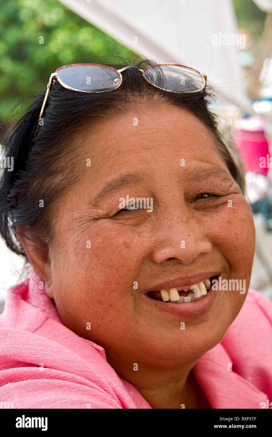 Missing teeth woman hi-res stock photography and images - Alamy Missing teeth woman hi-res stock photography and images - Alamy