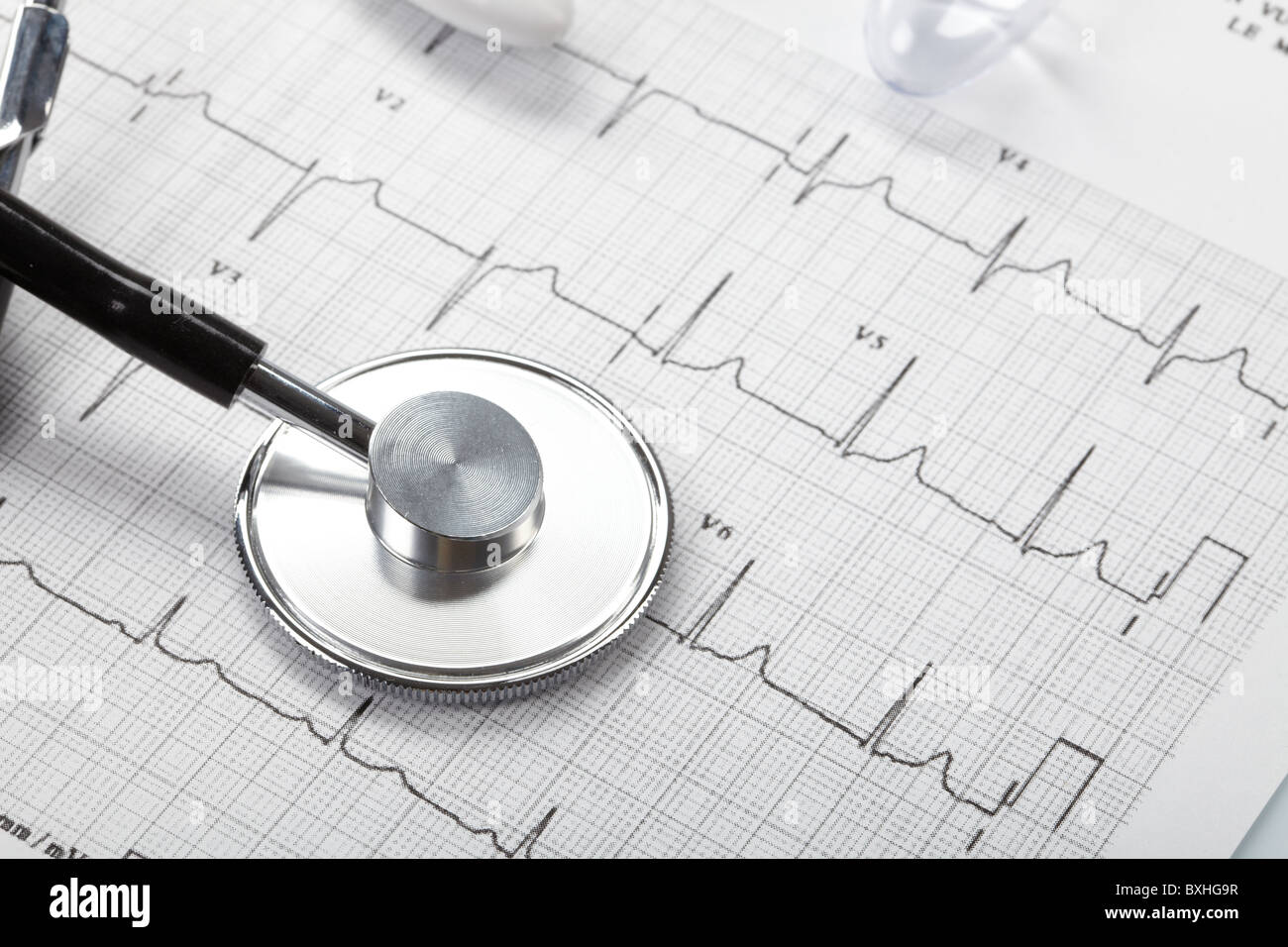 stethoscope on the cardiogram Stock Photo - Alamy
