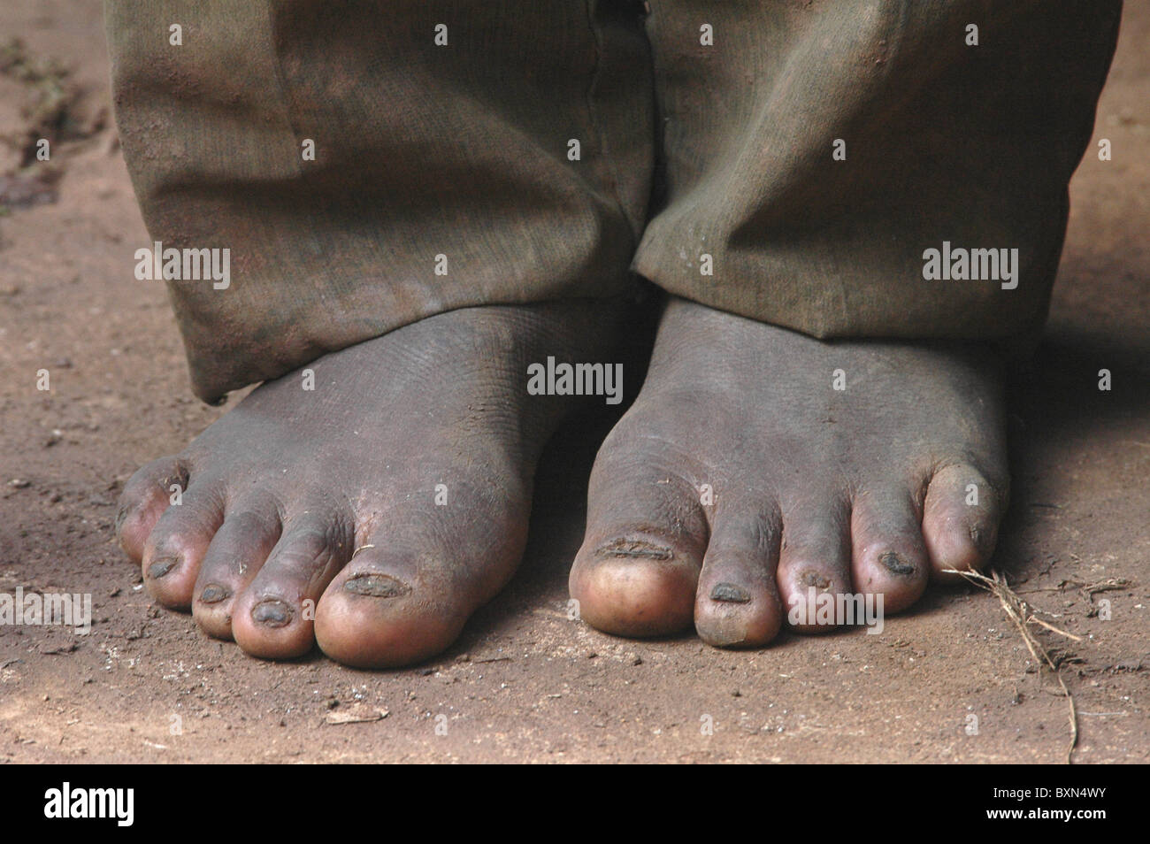 Bare African Feet Stock Photo - Alamy