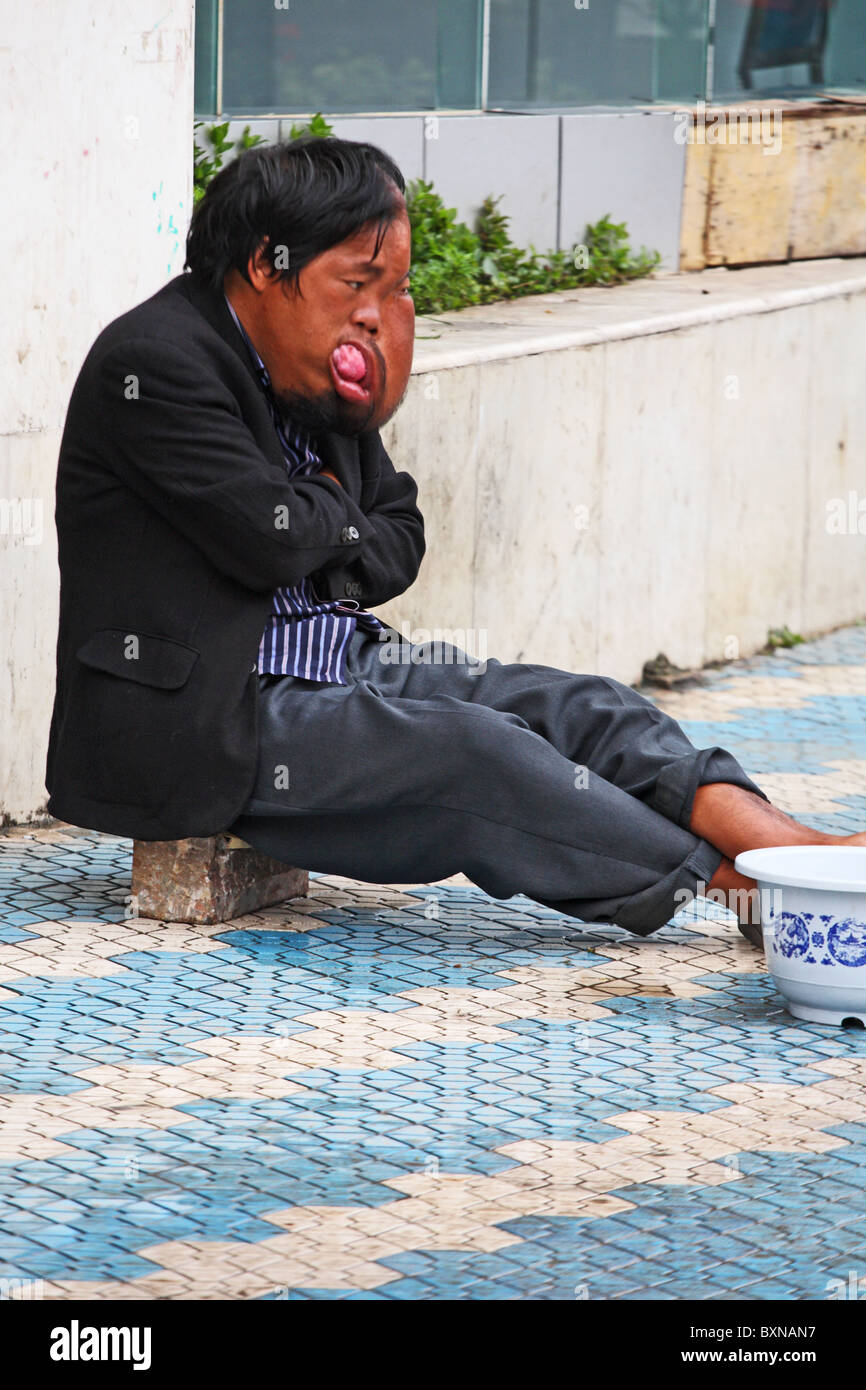 Disfigured face hi-res stock photography and images - Alamy