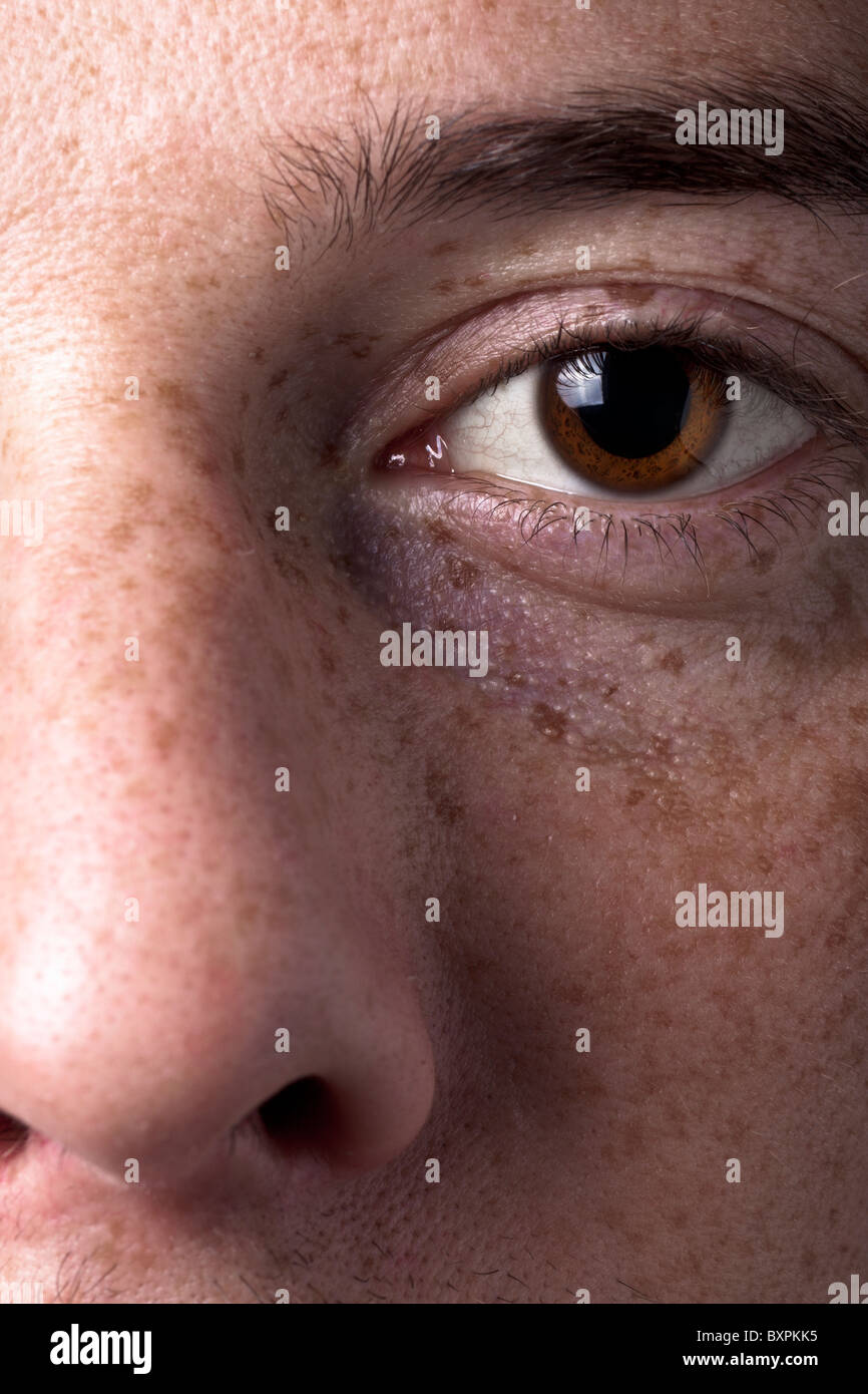 Eye and Freckles Stock Photo - Alamy