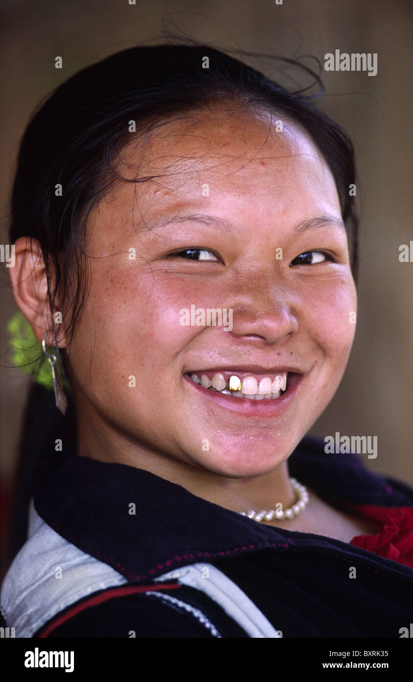 Black Hmong girl with gold tooth. Sapa, Lao Cai Province, Northern ...