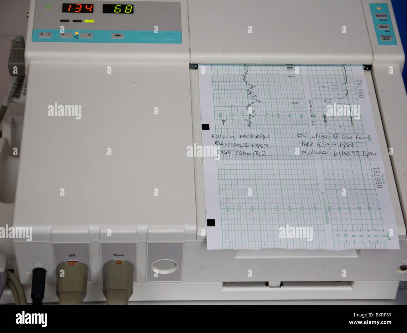 External Fetal Heart Rate Monitor at John Mallery blog
