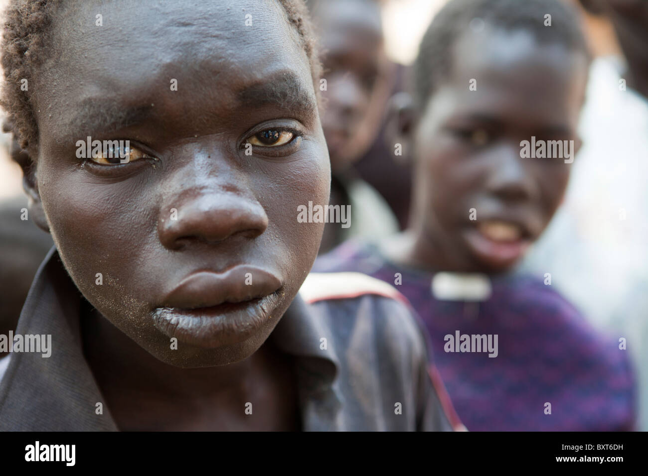 Nodding Disease, an incurable degenerative brain disease, attacks ...