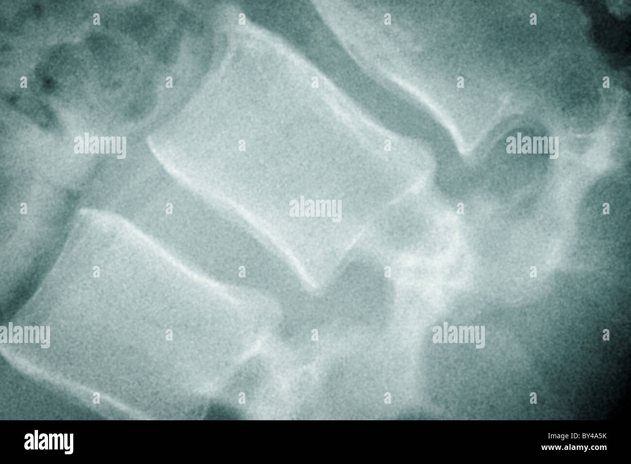 Back anatomy hi-res stock photography and images - Alamy