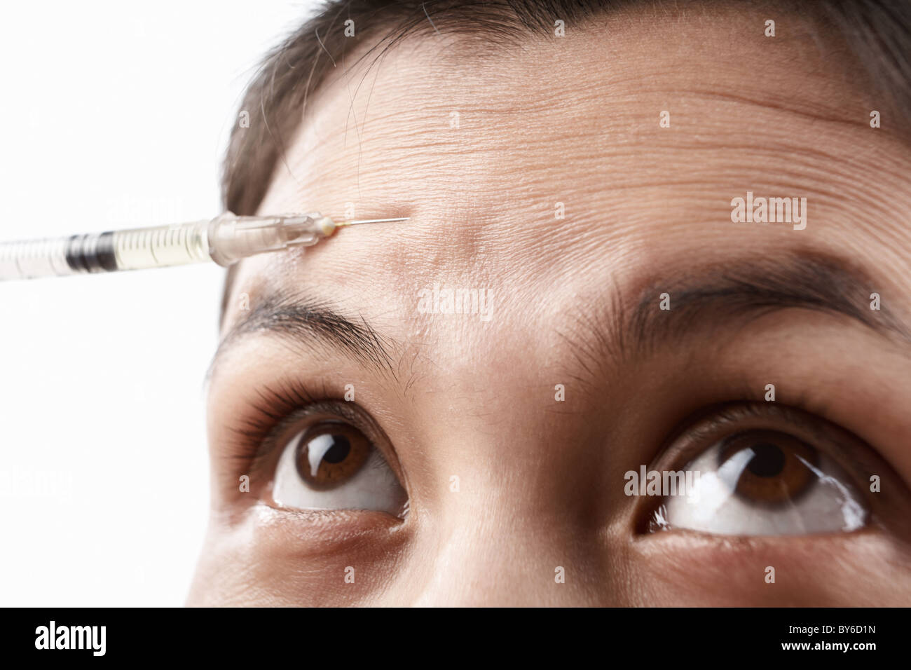 Woman face with botox injectionin forehead area Stock Photo - Alamy
