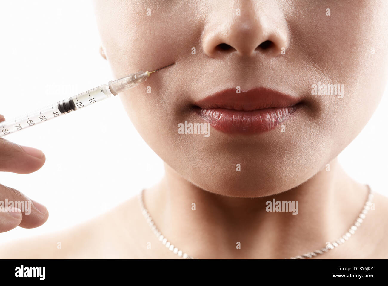 Woman face with botox injection in the cheek area Stock Photo - Alamy