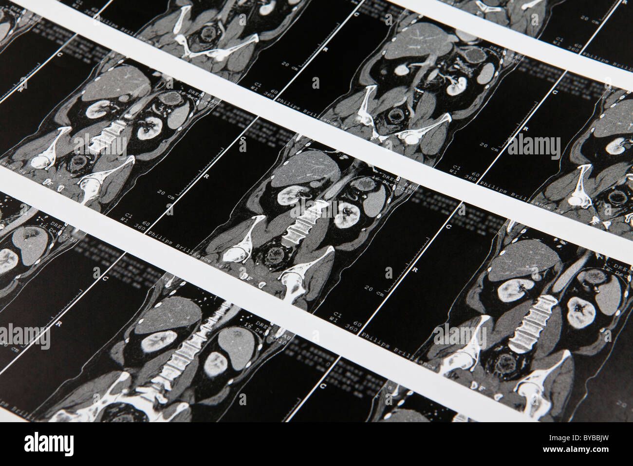 Multi-slice computed tomography, magnetic resonance imaging, MRI ...