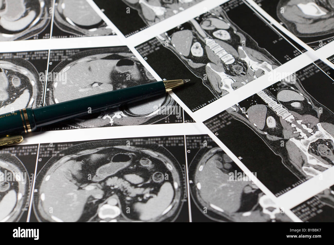 Multi-slice computed tomography, magnetic resonance imaging, MRI ...