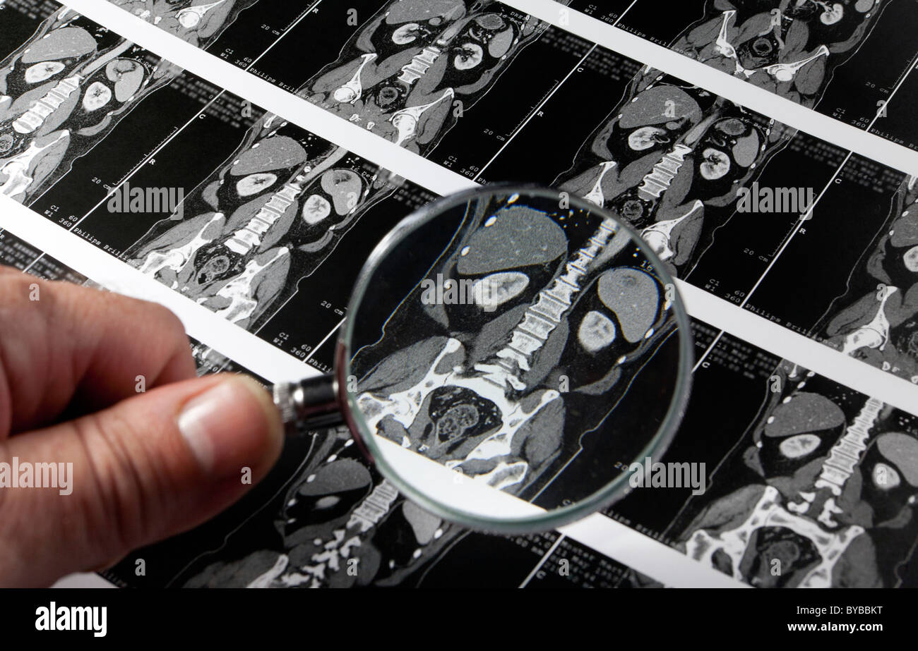 Multi-slice computed tomography, magnetic resonance imaging, MRI ...