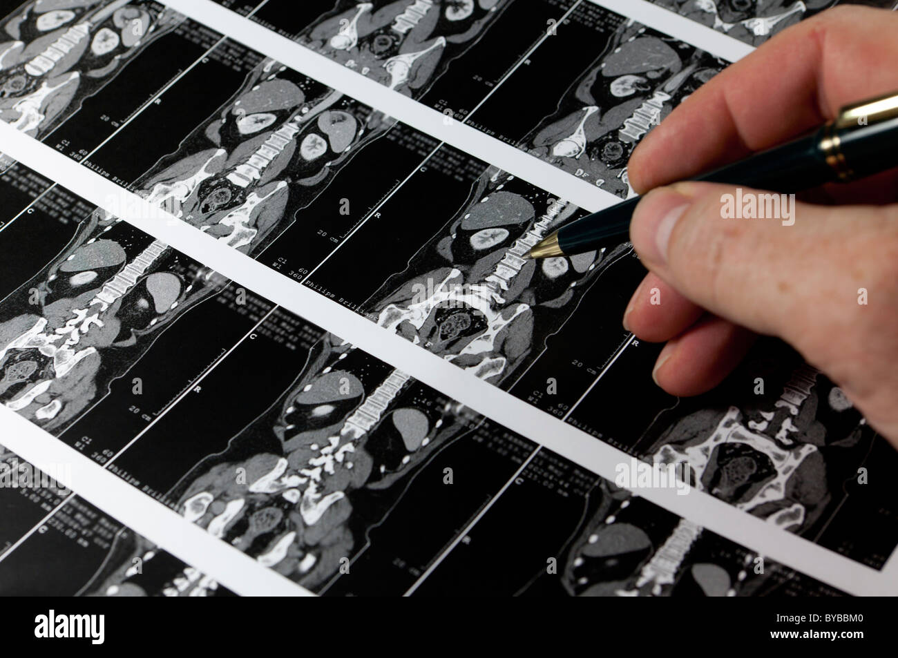 Multi-slice computed tomography, magnetic resonance imaging, MRI ...
