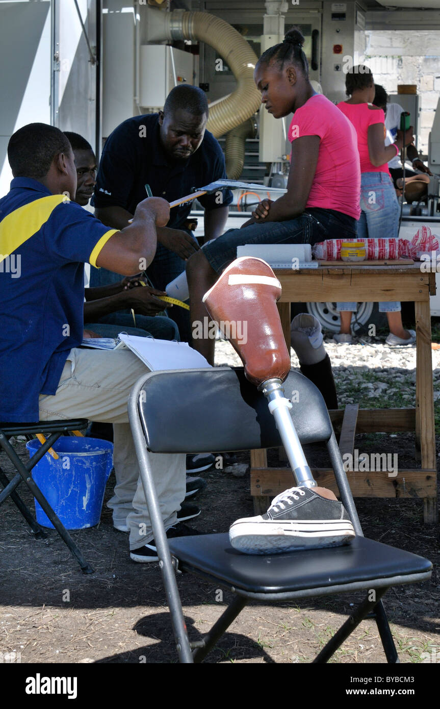 Fitting of an artificial limb for a young woman who lost her leg in an ...