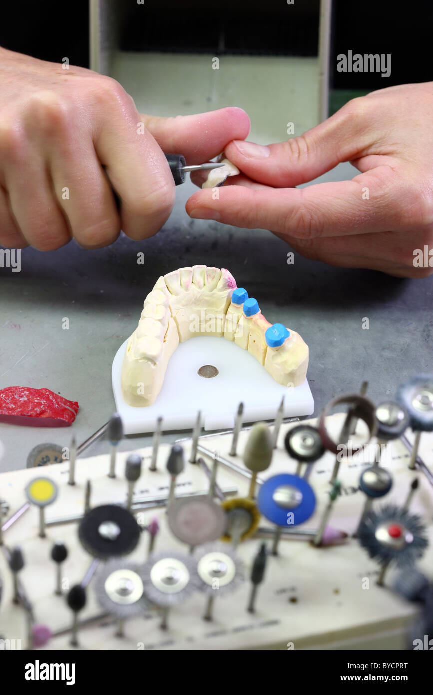 Dental laboratory, dental technician at work, making of tooth bridges ...