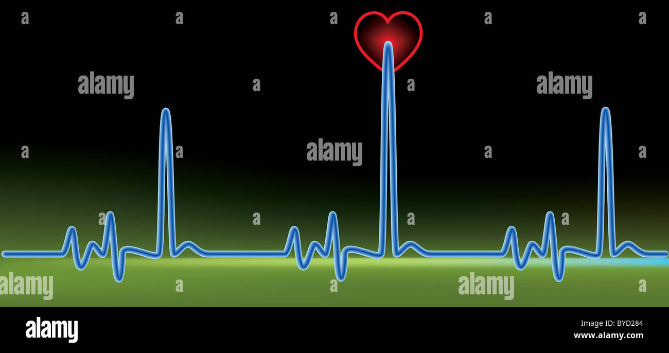 Monitor with blue heart beat Stock Photo - Alamy