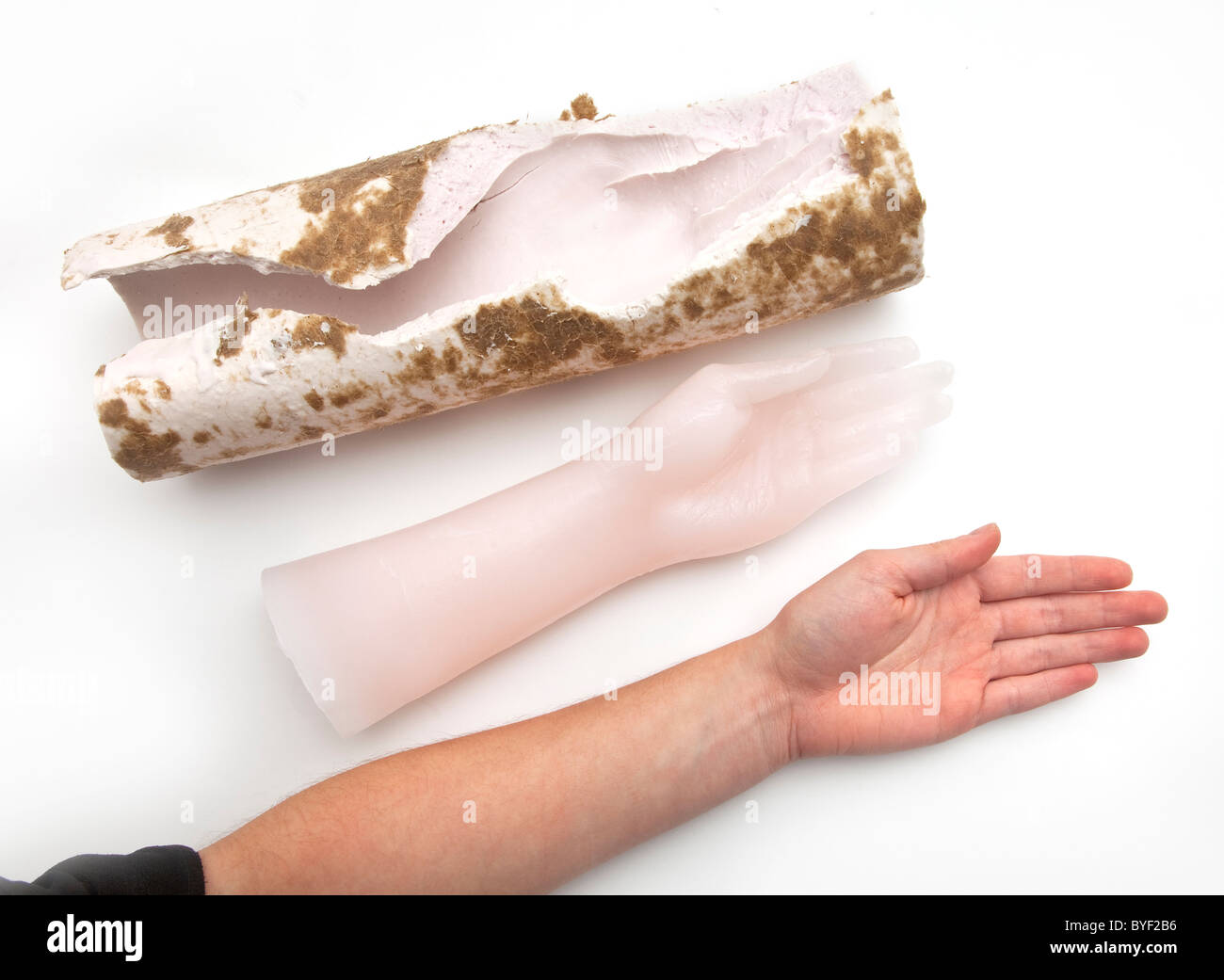 Alginate mould and wax copy taken from the mould of an arm and hand ...