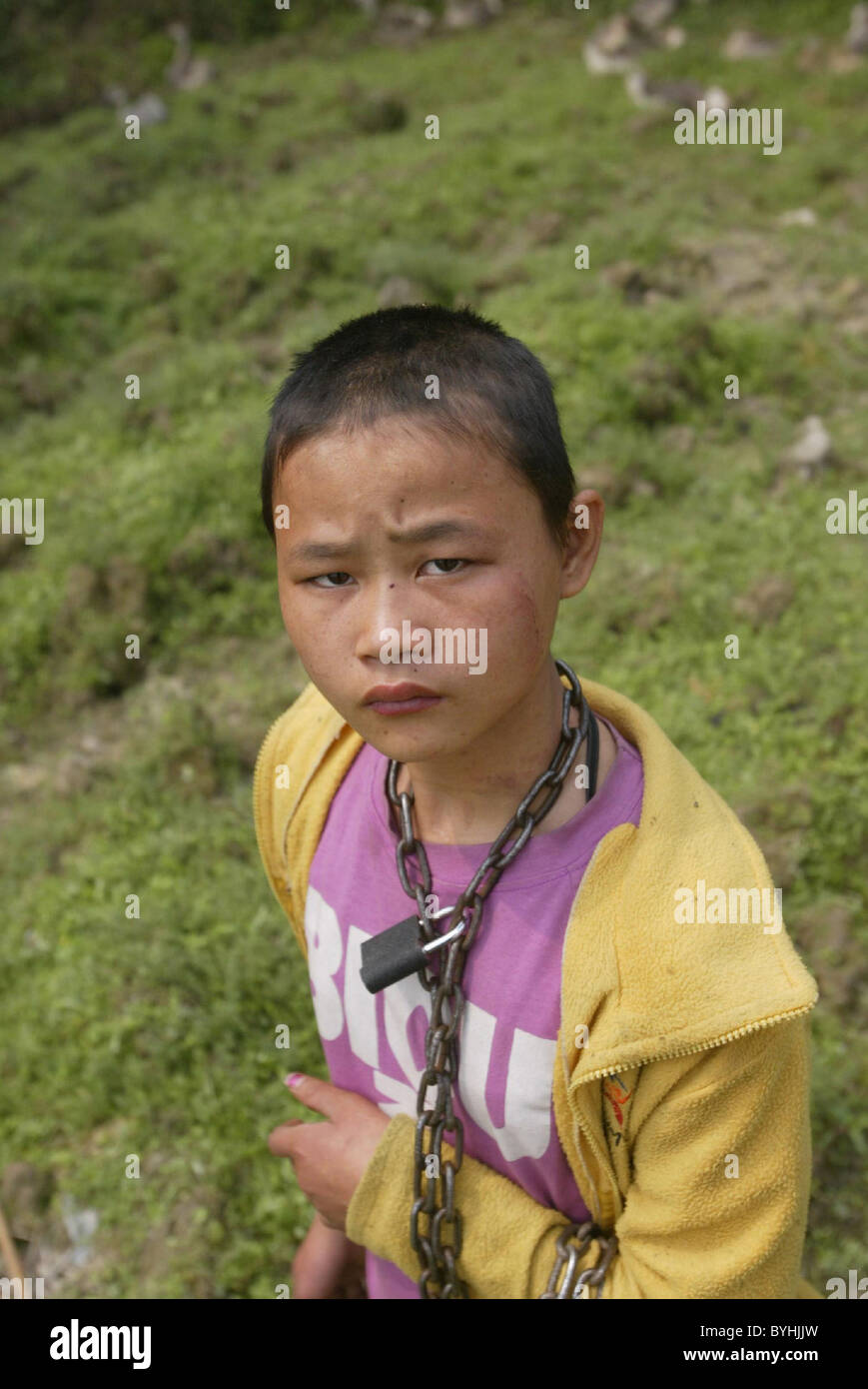 CHAIN GIRL FREED Wearing a heavy iron chain around her neck, this poor ...