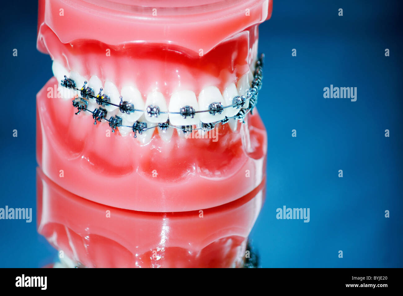 Braces For Teeth High Resolution Stock Photography and Images - Alamy