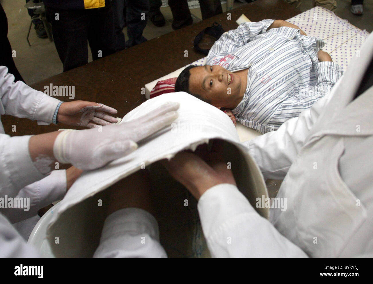 HALF MAN GETS INTO SHAPE FOR ARTIFICIAL LIMBS Medical staff, at the ...