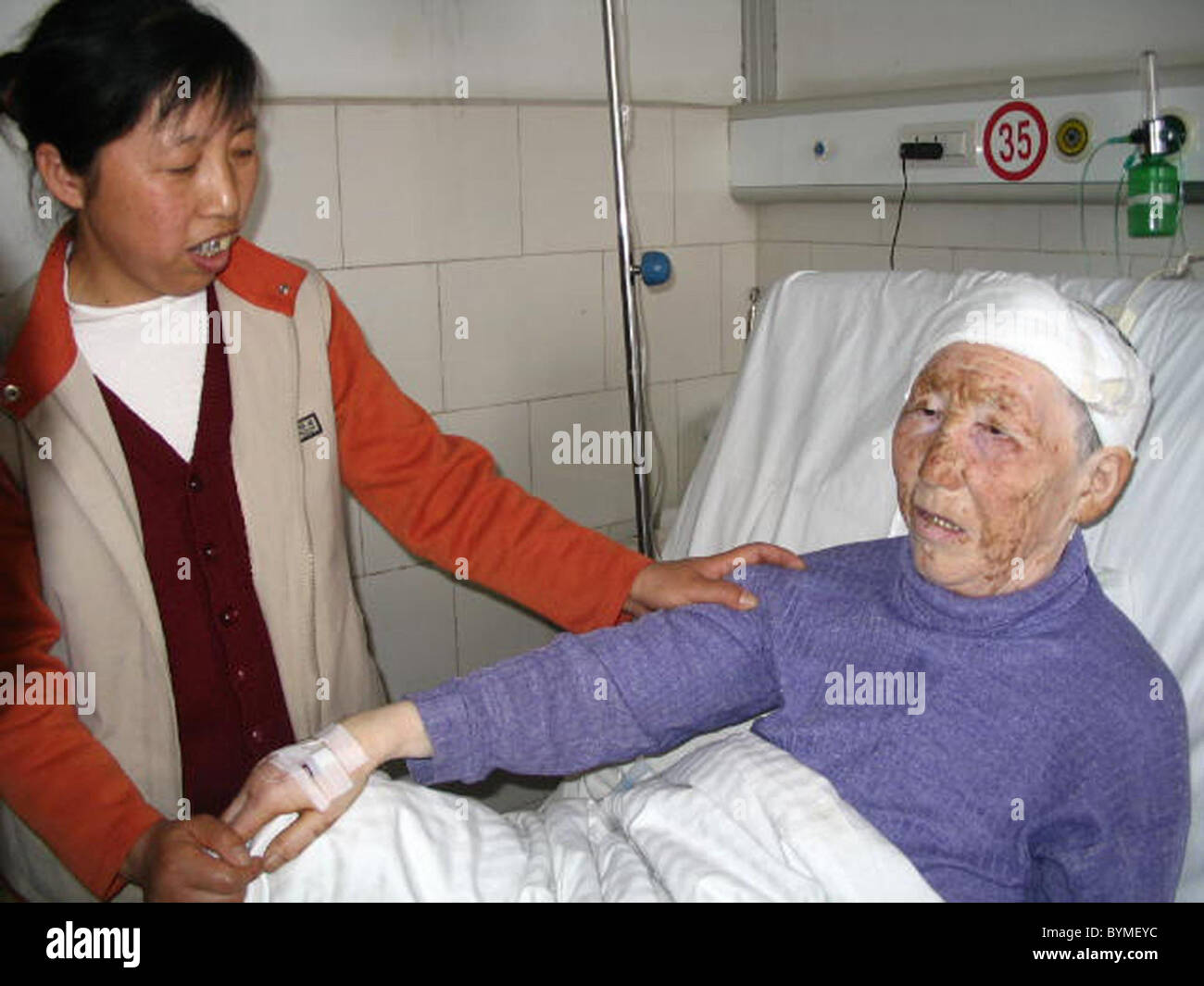 HEADACHE FROM HELL A Chinese grandmother suffering persistent headaches ...