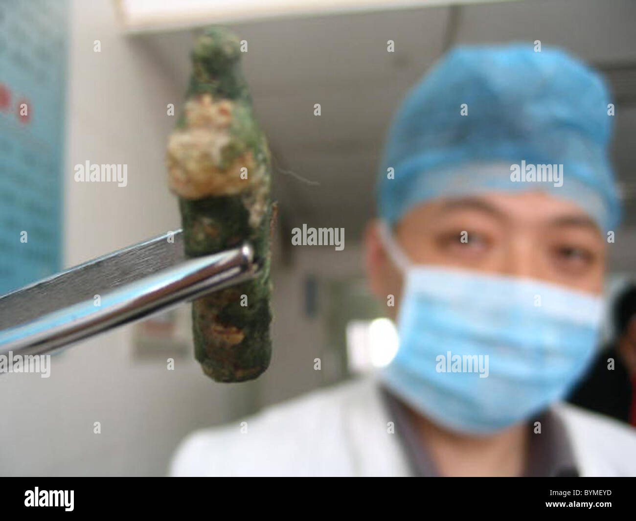 HEADACHE FROM HELL A Chinese grandmother suffering persistent headaches ...