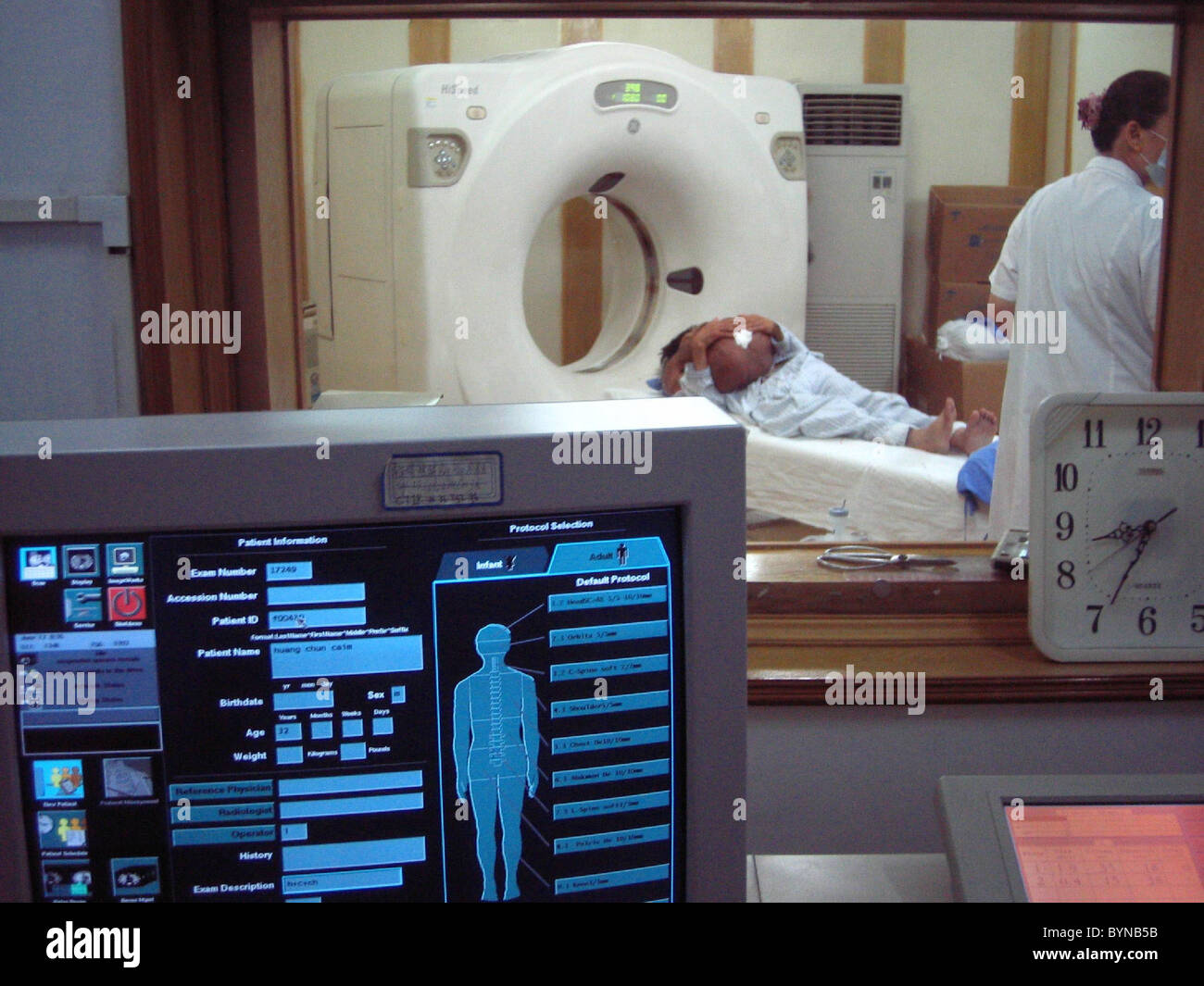 THE ELEPHANT MAN Doctors believe Huang Chuncai, 31, from Chenzhou in ...