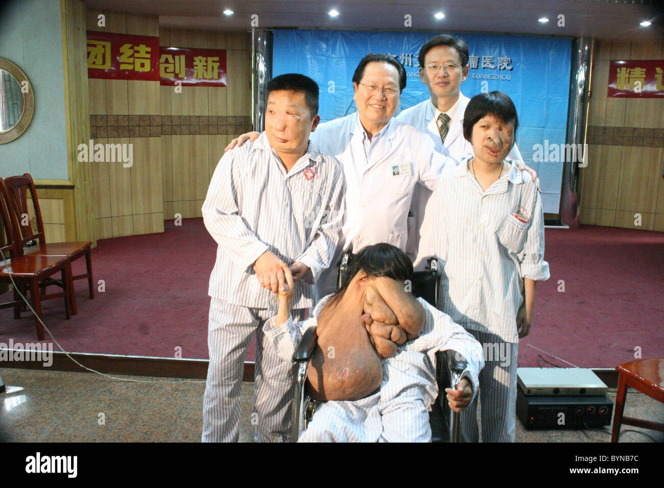 THE ELEPHANT MAN Doctors believe Huang Chuncai, 31, from Chenzhou in ...