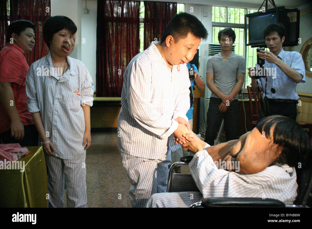 THE ELEPHANT MAN Doctors believe Huang Chuncai, 31, from Chenzhou in ...
