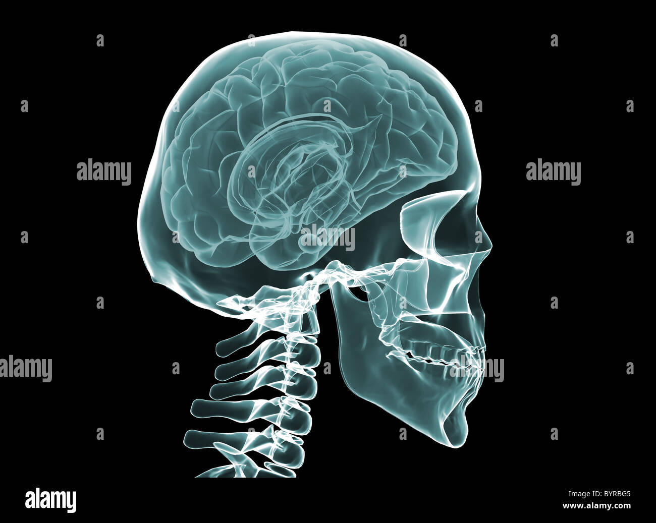 X Ray Brain Front