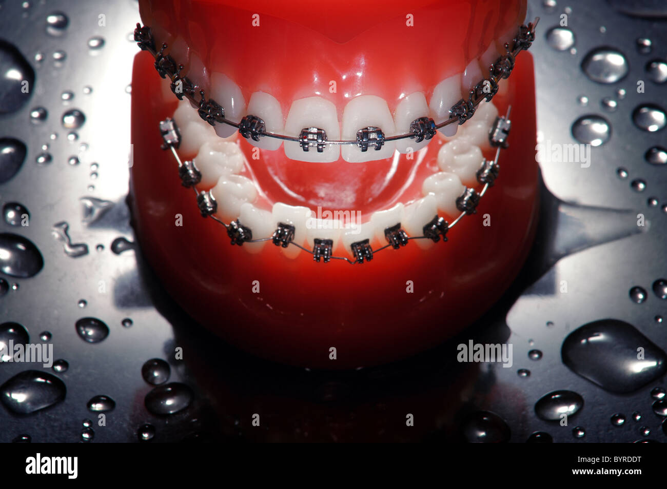Open dentures with braces , water drops background Stock Photo - Alamy